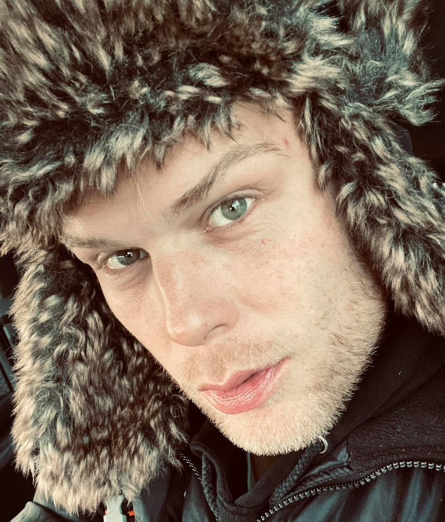 Auts! Aki Samuli “konttasi tupaan” isovarvas kahdesta kohtaa murtuneena ...